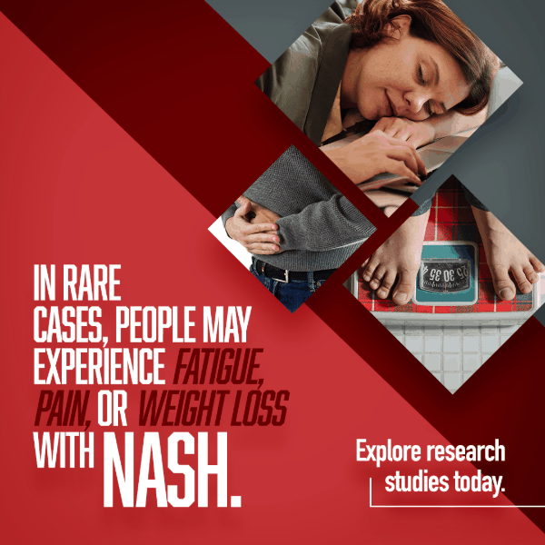 NASH: A Modern Lifestyle Disease - Arizona Liver Health