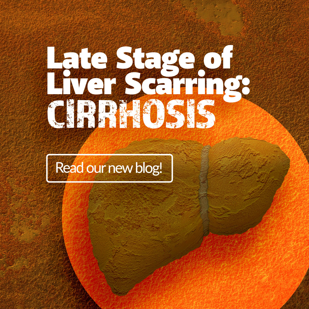 A Complication Of Liver Disease Cirrhosis Arizona Liver Health